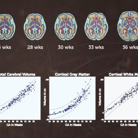Every day fetuses remain in utero critical to preserving normal brain ...