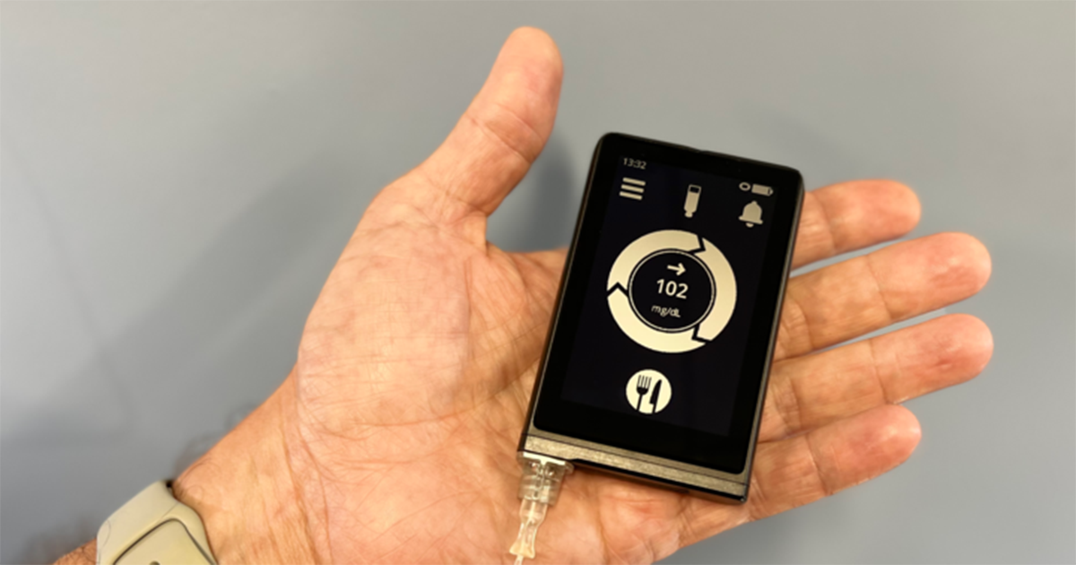 Bionic pancreas improves Type 1 diabetes management - Children's National