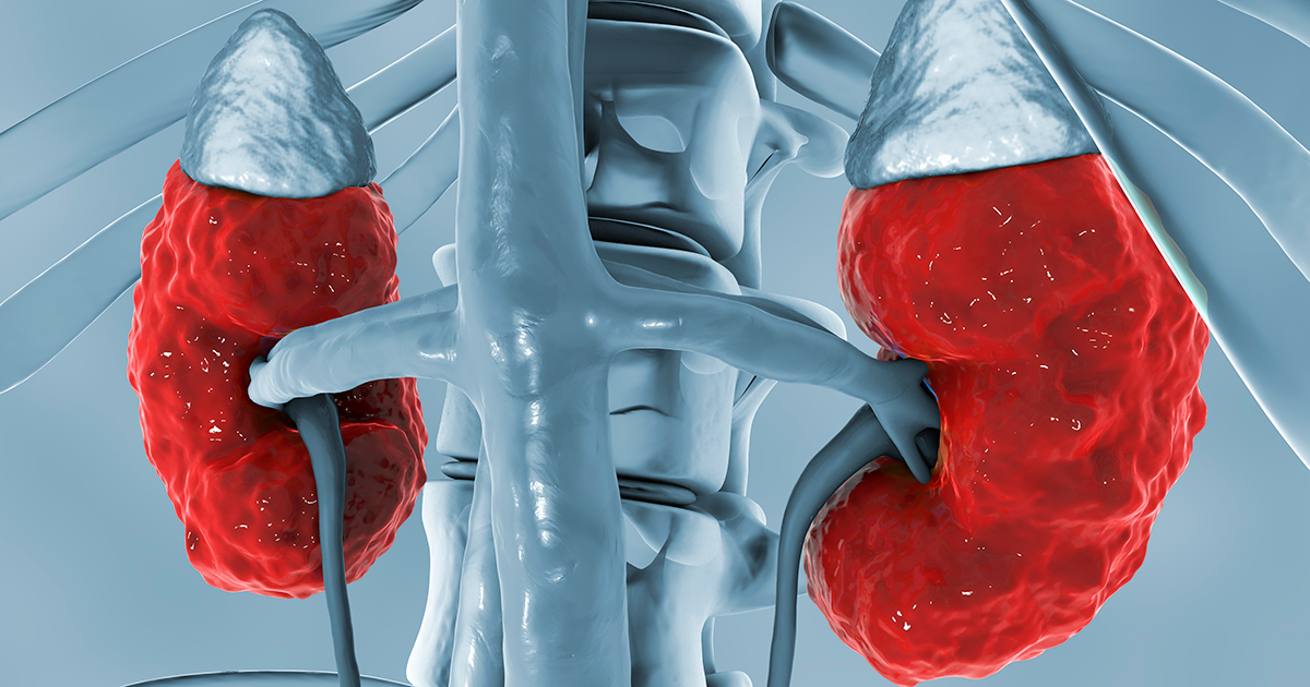 Cardiovascular and bone diseases in chronic kidney disease - Children's ...