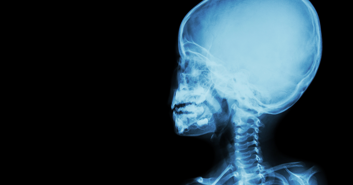 Experts reach consensus in study using modified Delphi technique ...