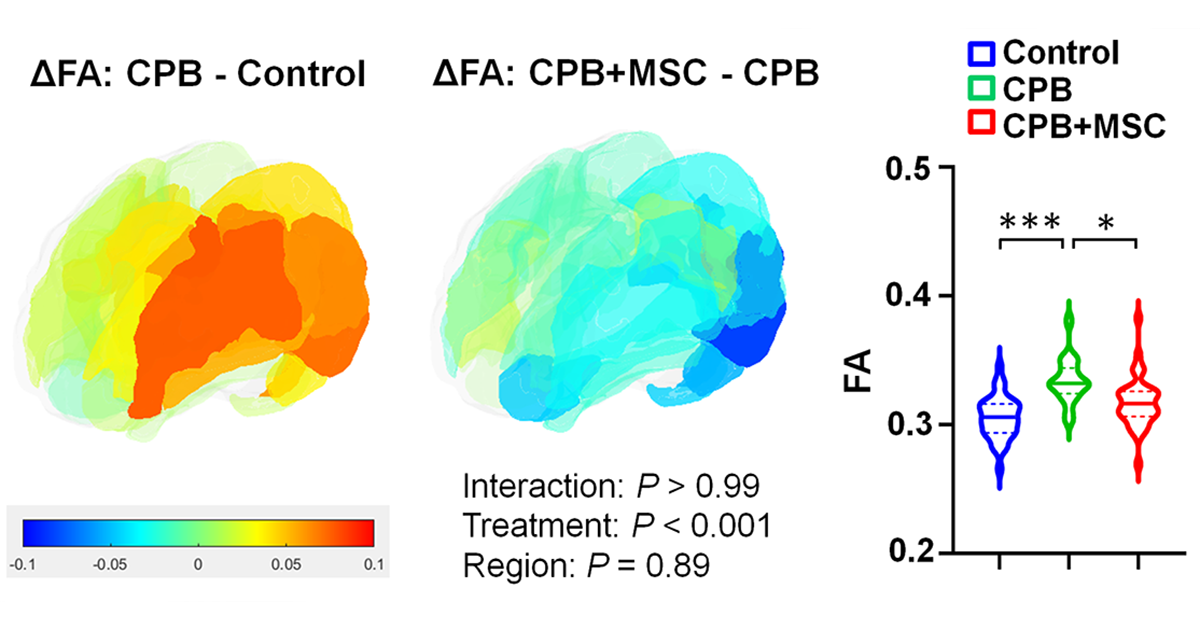 Cell therapy mitigates neurological impacts of cardiac surgery ...