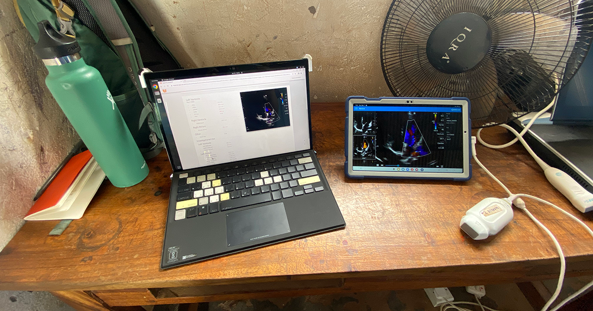 Novel AI platform detects rheumatic heart disease - Children's National