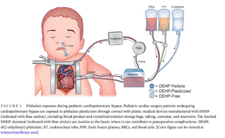 Pediatric heart patients exposed to plastic chemicals during ...